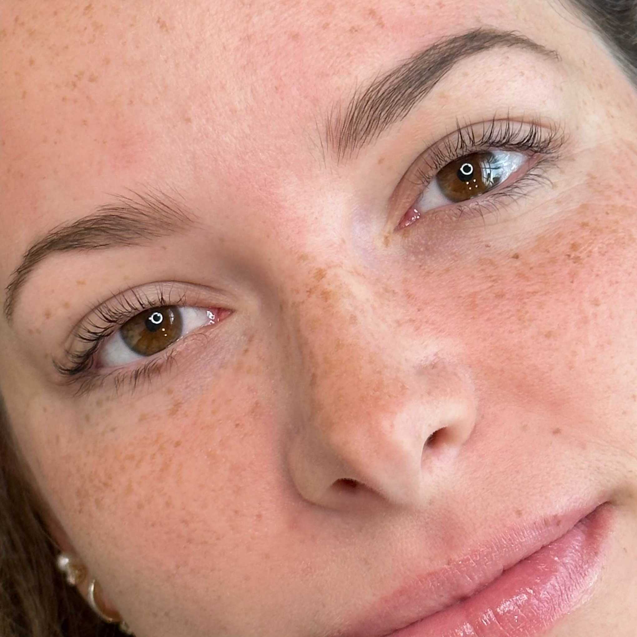 Microneedling At DAELA Portland