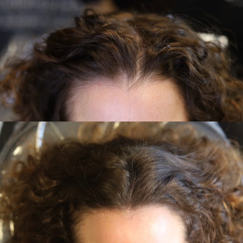 Scalp Micropigmentation In Portland | DAELA Cosmetic Tattoo