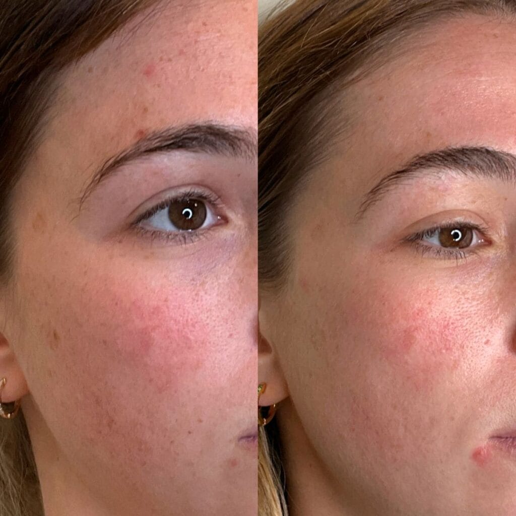 Laser Skin Treatments Scottsdale | DAELA Cosmetic Tattoo