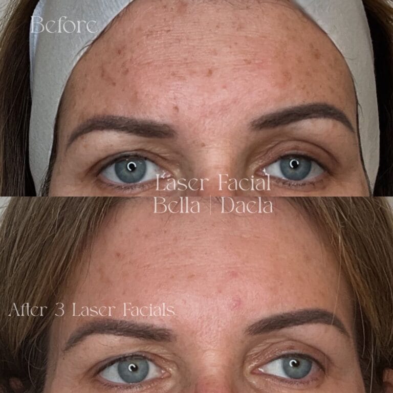 Laser Skin Treatments Scottsdale | DAELA Cosmetic Tattoo