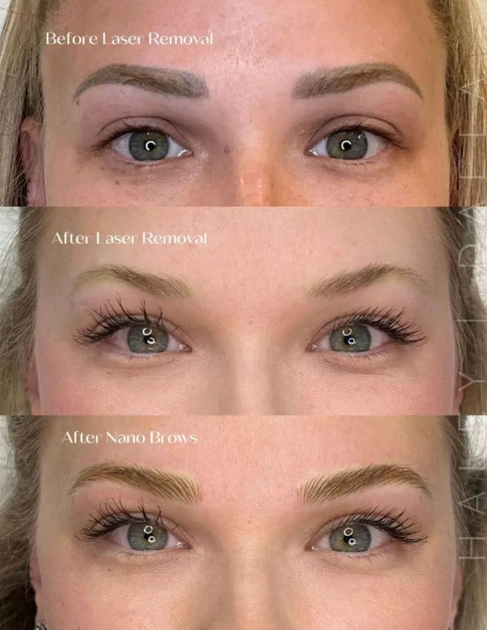 Permanent Makeup In Scottsdale | DAELA Cosmetic Tattoo