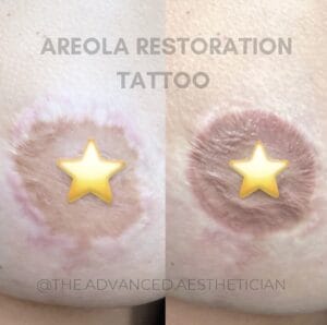 3D Nipple & Areola Restoration Tattoo | DAELA Cosmetic Tattoo