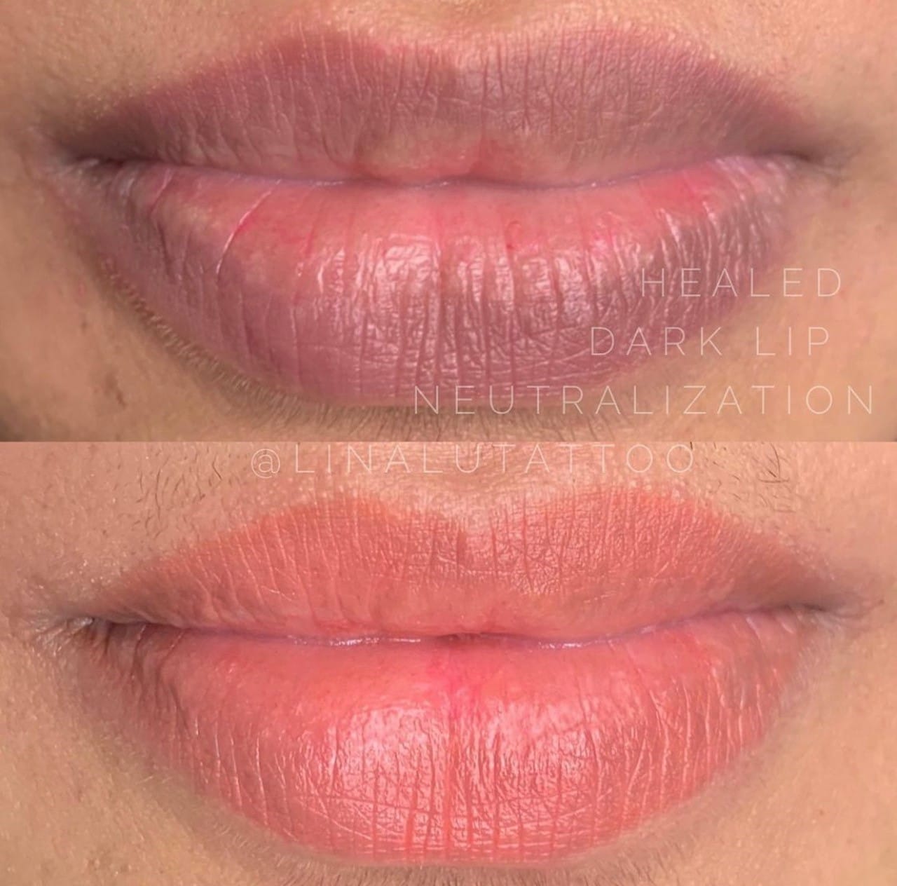Lip Blush Tattoo For Dark Lip Neutralization. Daela Cosmetic Tattoo