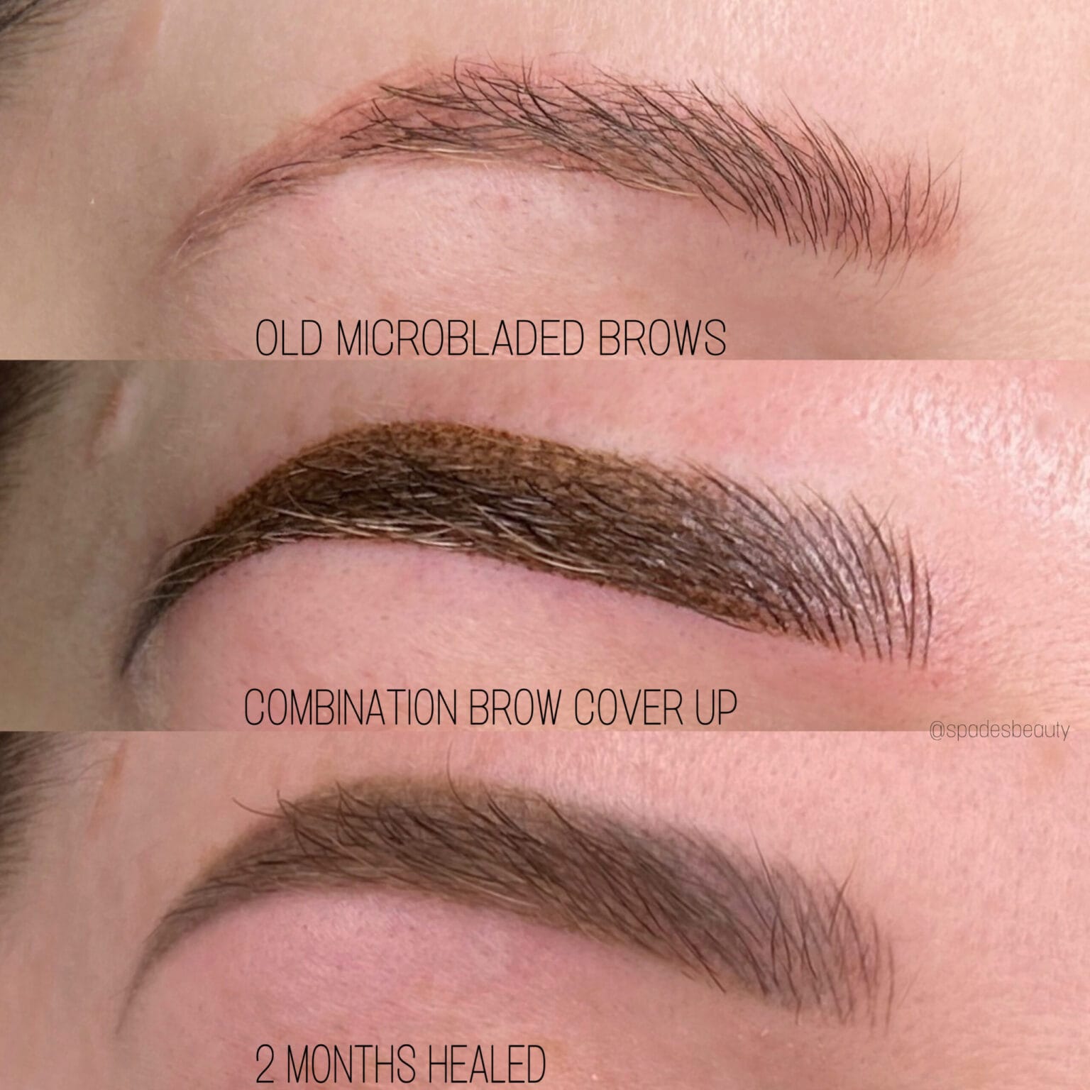 Powder Brows Vs. Microblading: Key Differences | DAELA