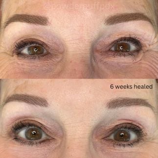 Brow Shock: 6 Things To Understand | DAELA