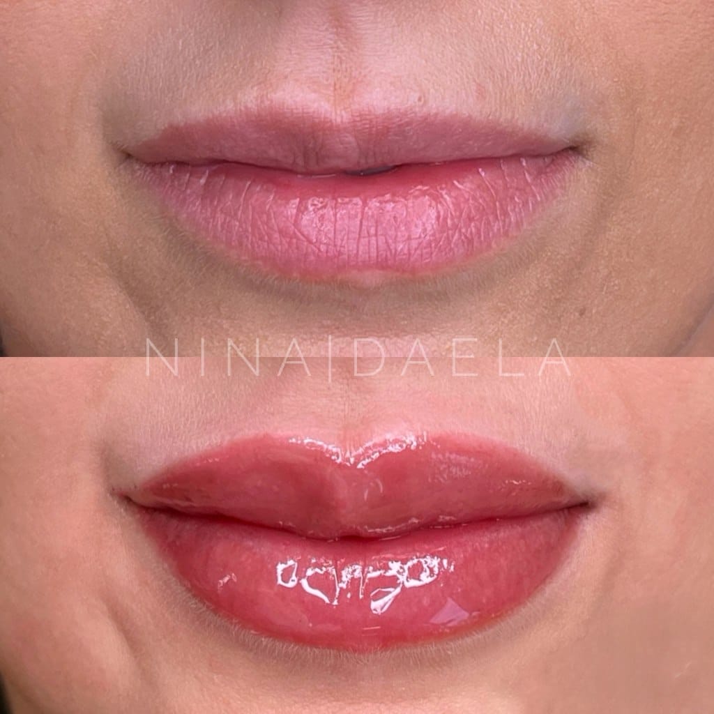 Lip Blush Tattoo: Step-by-Fabulous-Step | DAELA
