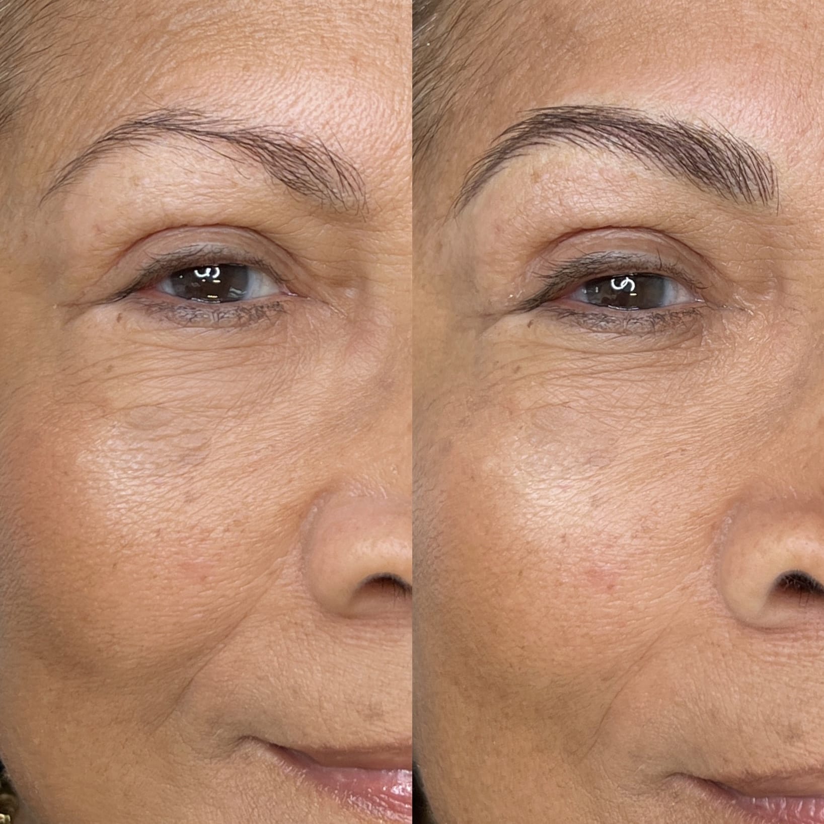 Machine Nano Brows In Scottsdale: Are They Right For You? | DAELA