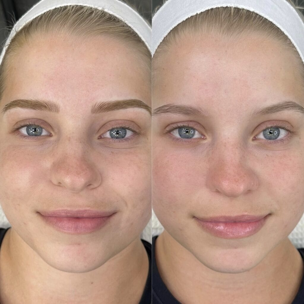 Permanent Makeup In Scottsdale Arizona | DAELA