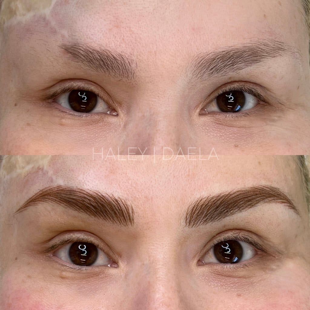 Brow Tattoos For Scar And Gap Coverage | DAELA