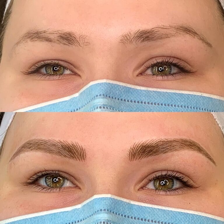 Brow Tattoos For Scar And Gap Coverage | DAELA