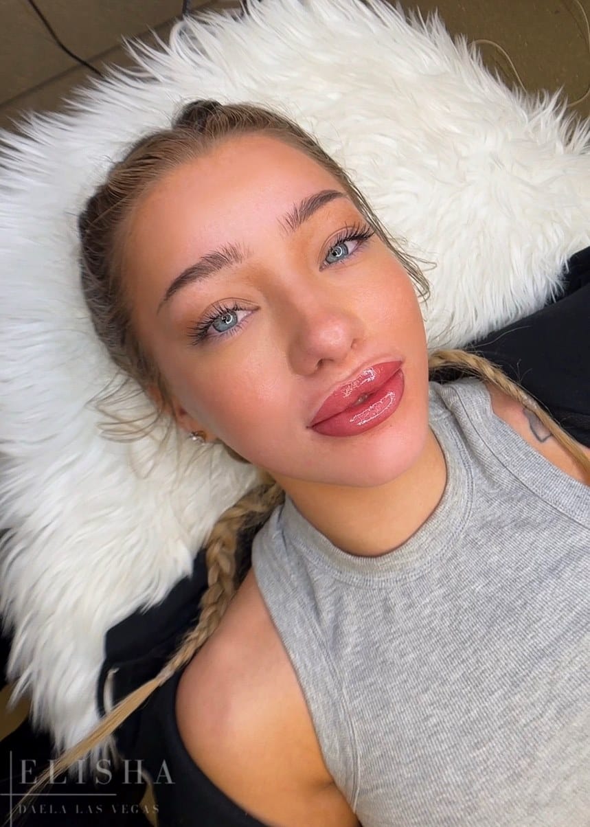 Enhancing Natural Beauty: Allie Harding’s Lip Blush Transformation | DAELA