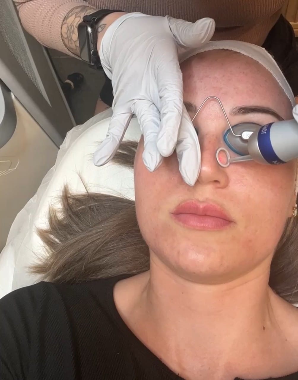 Laser Skin Treatments For Every Age | DAELA