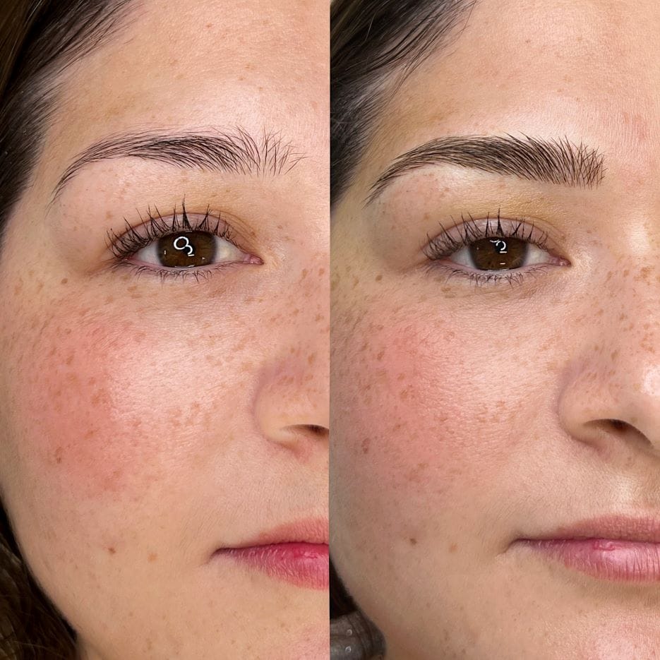 Brow Lamination Vs. Microblading: Which Is Right For You? | DAELA