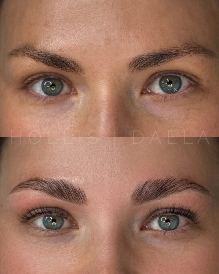 Brow Lamination Vs. Microblading: Which Is Right For You? | DAELA