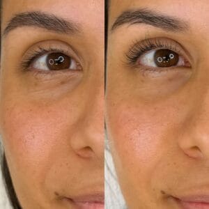 Lash Lift And Tint: What It Is, How It Works & Benefits | DAELA