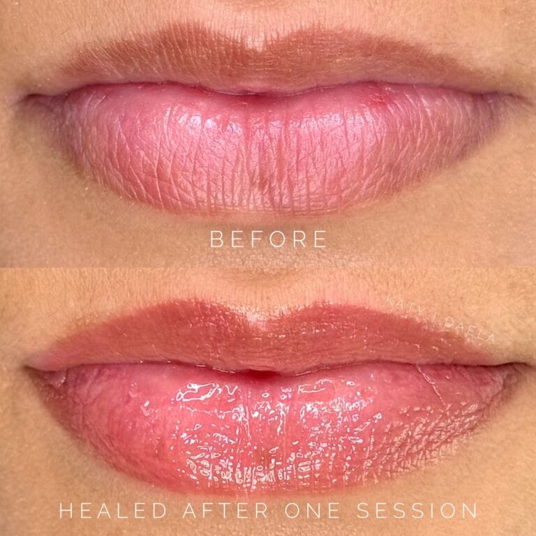 Lip Neutralization For Melanin-Rich Lips | DAELA