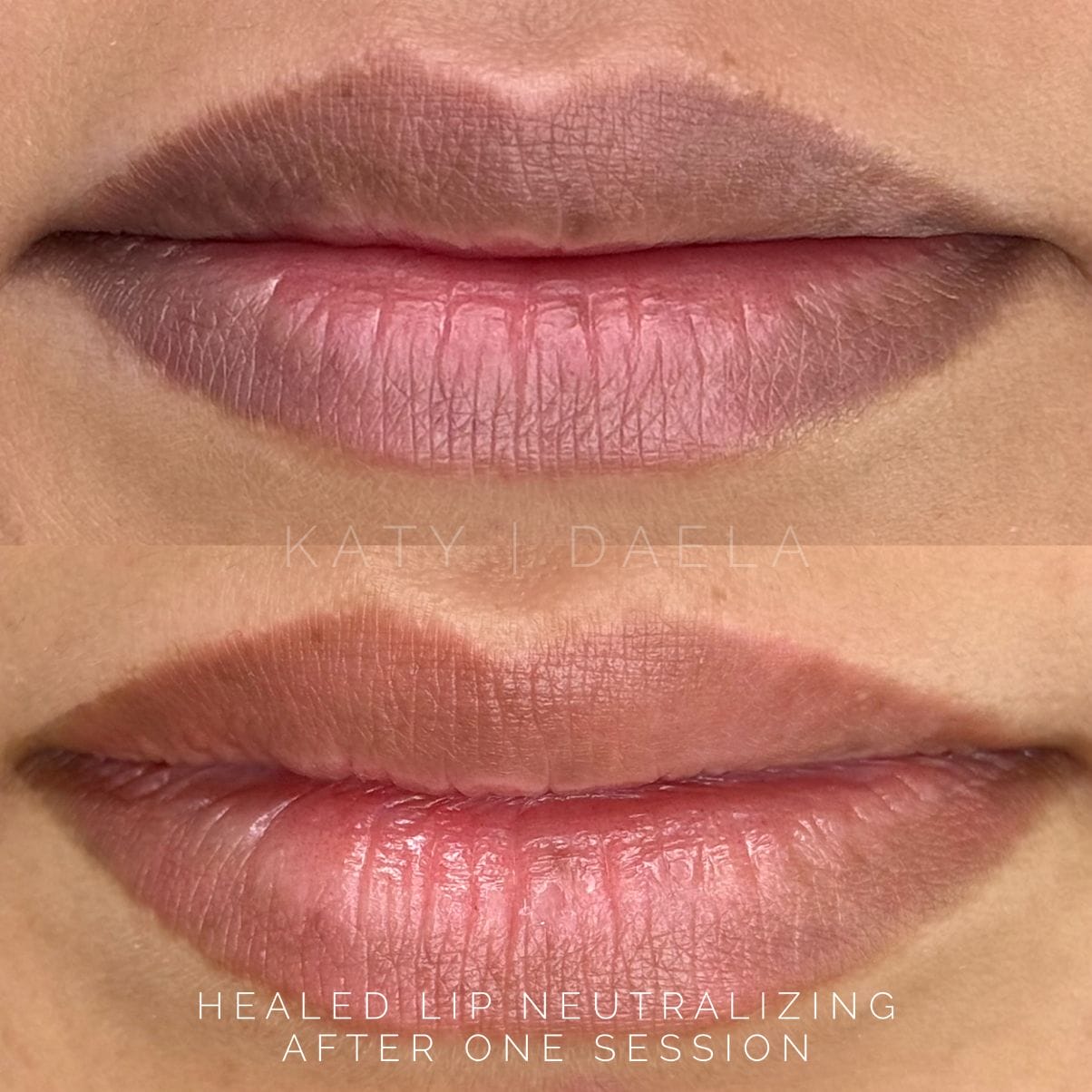 Lip Neutralization For Melanin-Rich Lips | DAELA