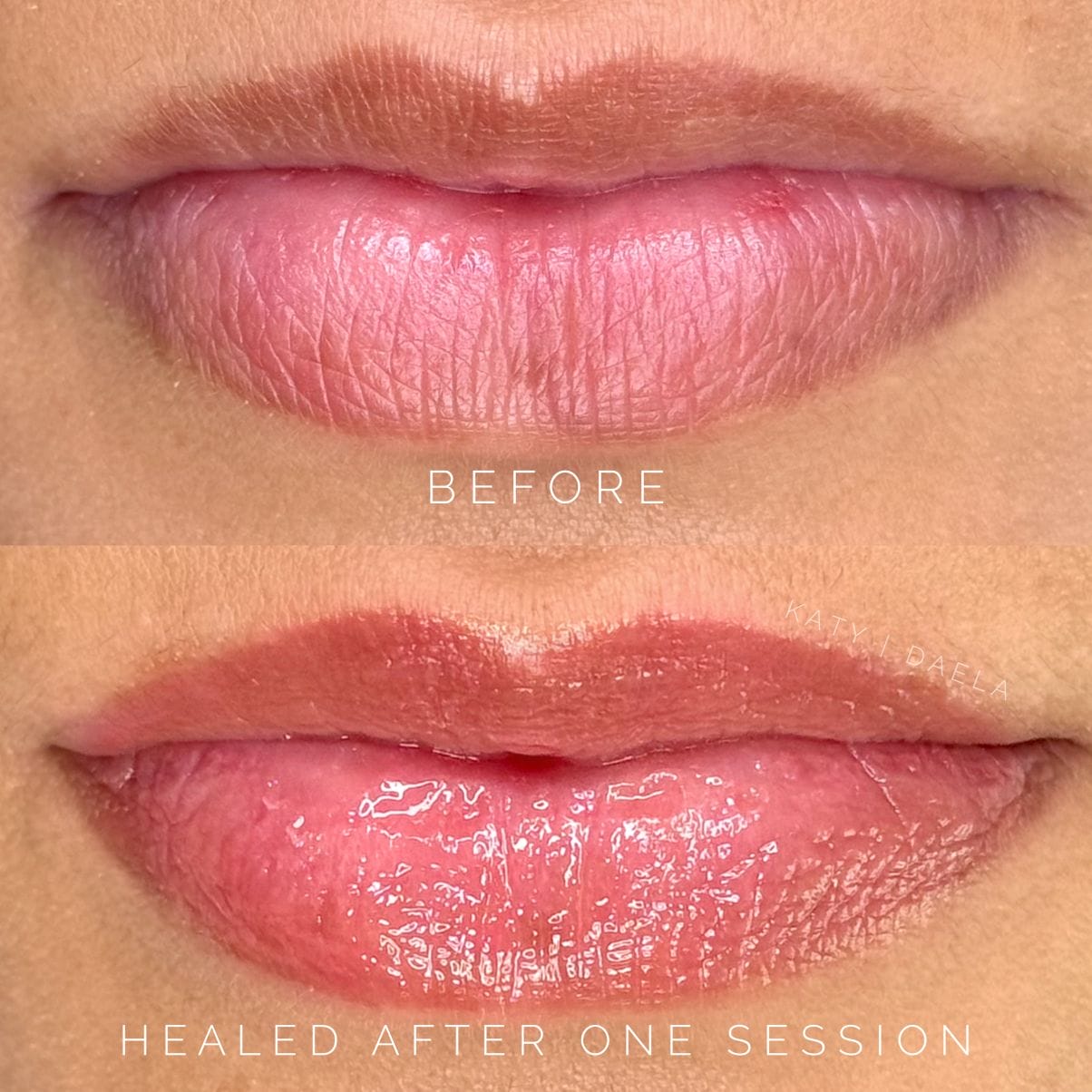 Lip Neutralization For Melanin-Rich Lips | DAELA
