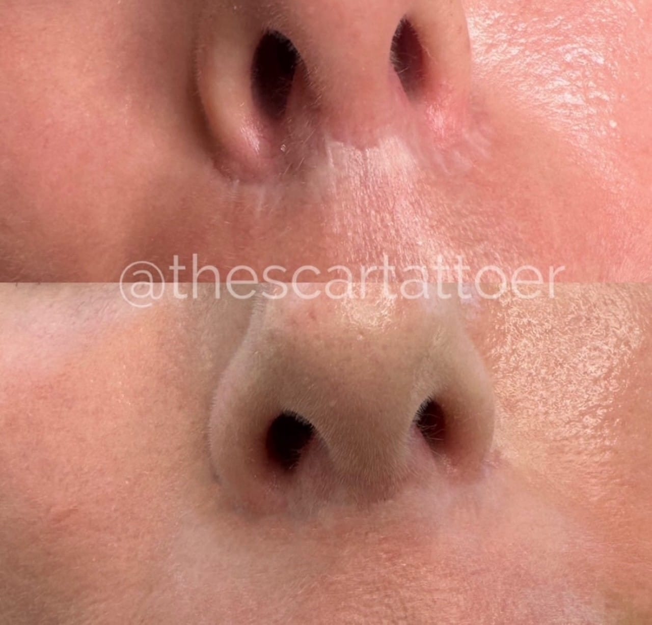 Lash Lift And Tint: What It Is, How It Works & Benefits | DAELA