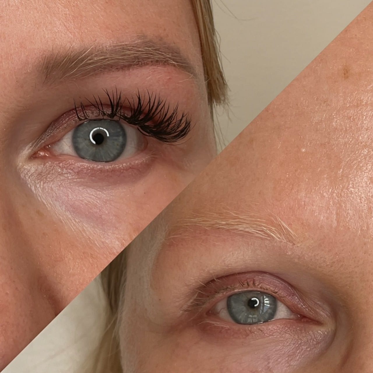 Cover Up My Old Brow Tattoo, Refresh It, Or Do I Need Tattoo Removal ...